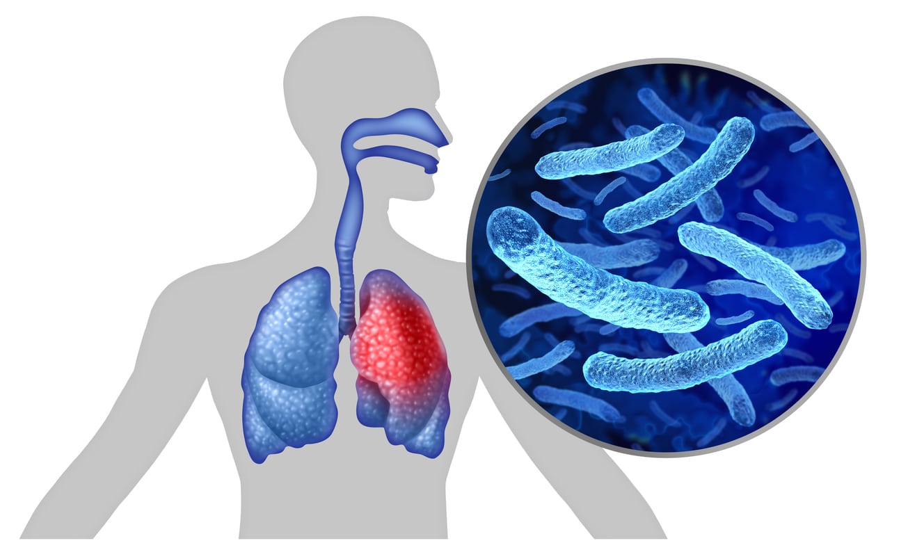 Texas Health Officials Report Deadly Legionnaire's Outbreak